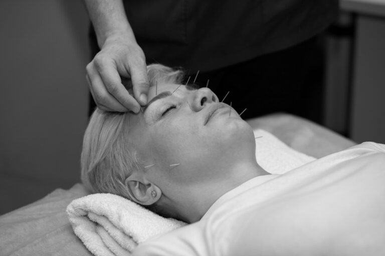 Your First Acupuncture Session: What to Expect and How to Prepare